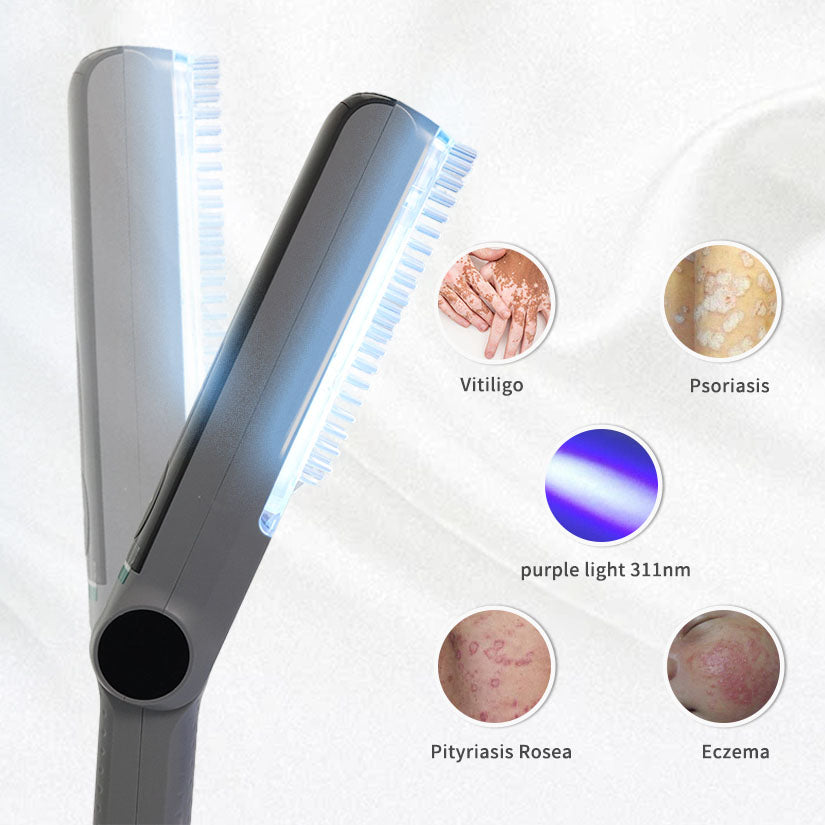 Comprehensive treatment plan for extensive vitiligo – Ziree